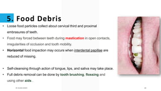Deposits on the Teeth | PDF
