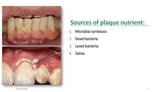 Deposits on the Teeth | PDF