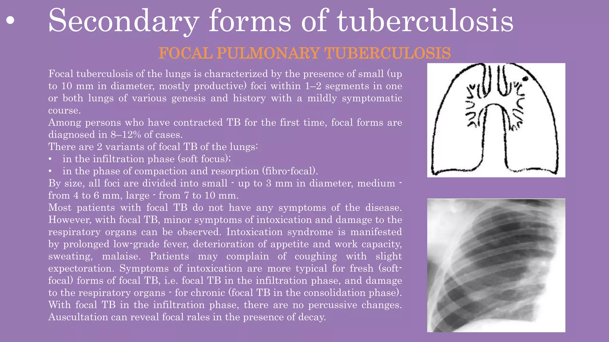 Primary and secondary forms of tuberculosis | PPTX