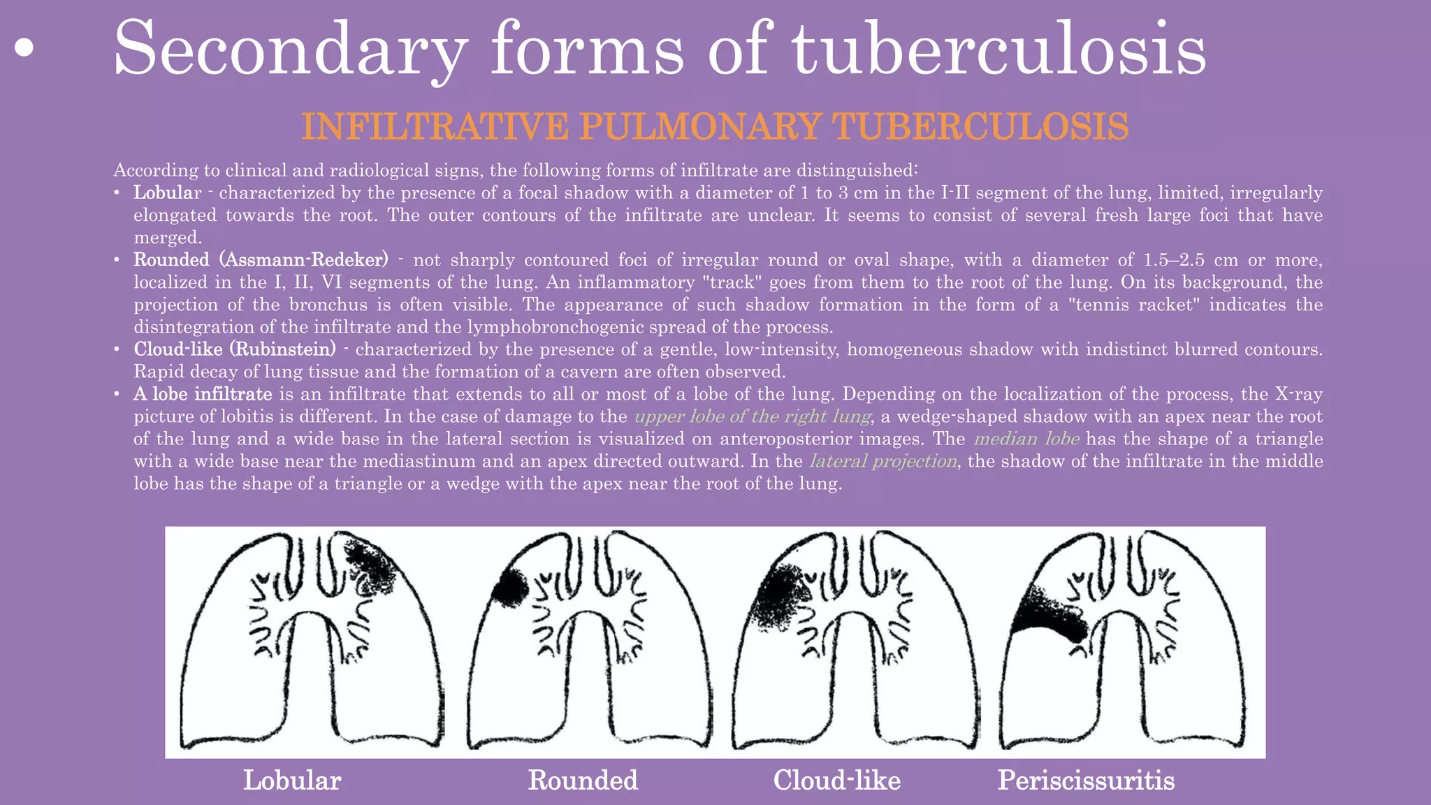 Primary and secondary forms of tuberculosis | PPTX