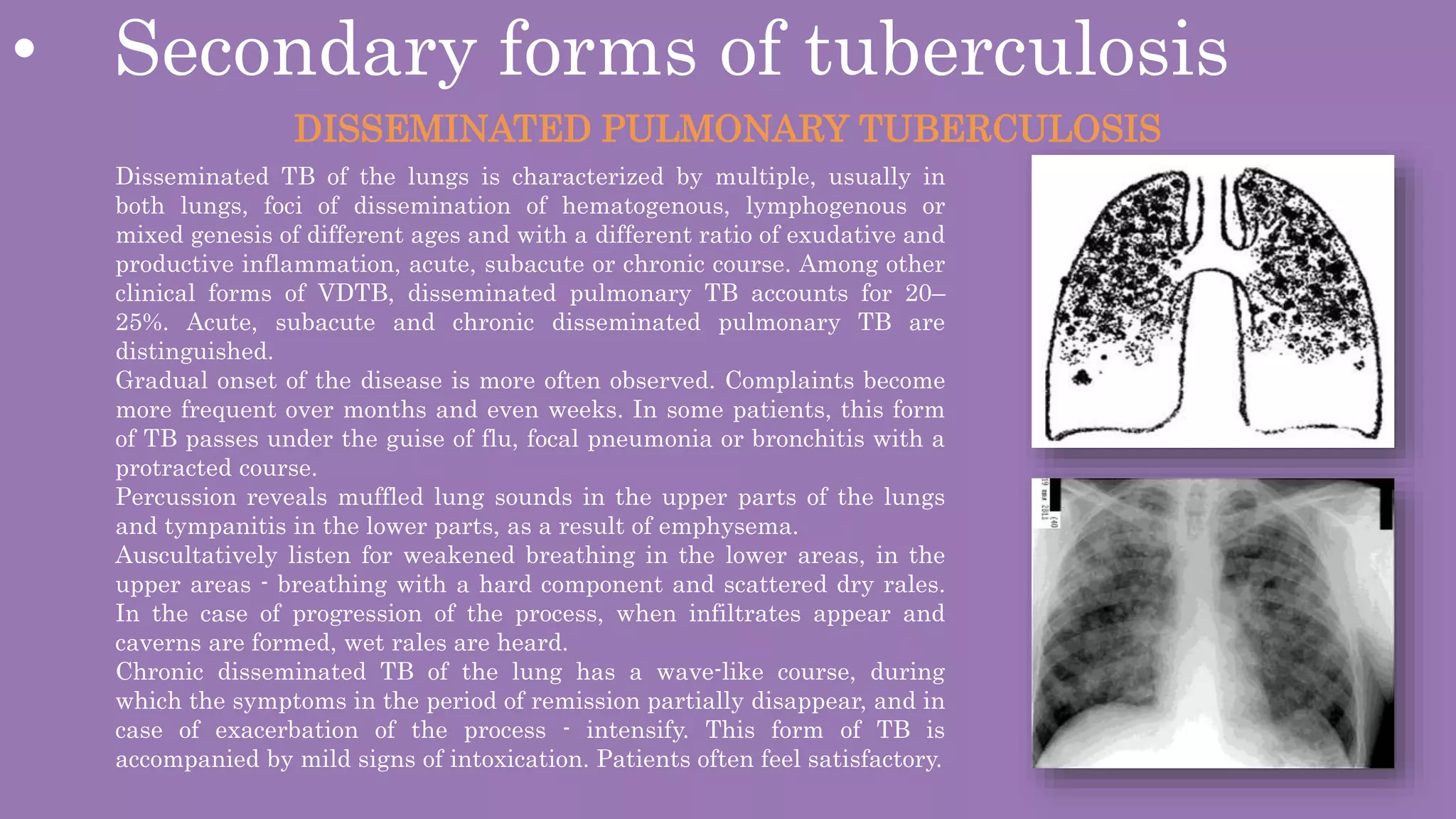Primary and secondary forms of tuberculosis | PPTX