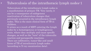Primary and secondary forms of tuberculosis | PPTX