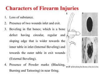 lecture 4. Firearm and burn buc.pptxmdvie | PPTX