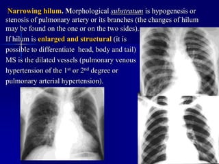 Lecture 4-5. Radiological semiotics of lung and mediastinum pathology..ppt