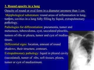 Lecture 4-5. Radiological semiotics of lung and mediastinum pathology..ppt