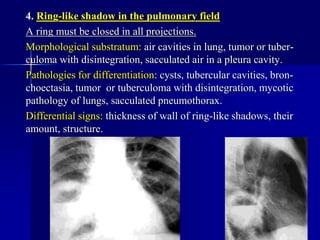 Lecture 4-5. Radiological semiotics of lung and mediastinum pathology..ppt