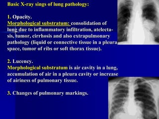 Lecture 4-5. Radiological semiotics of lung and mediastinum pathology..ppt