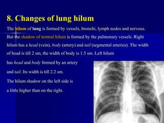 Lecture 4-5. Radiological semiotics of lung and mediastinum pathology..ppt