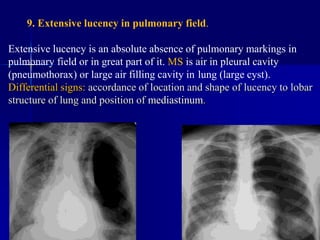 Lecture 4-5. Radiological semiotics of lung and mediastinum pathology..ppt