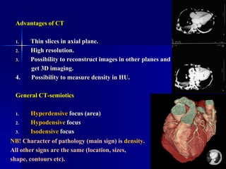 Lecture 4-5. Radiological semiotics of lung and mediastinum pathology..ppt