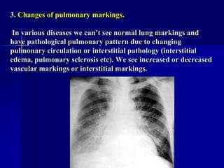Lecture 4-5. Radiological semiotics of lung and mediastinum pathology..ppt