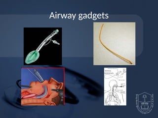 LECTURE4-Airway Management and equipment-.ppt