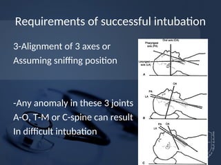 LECTURE4-Airway Management and equipment-.ppt