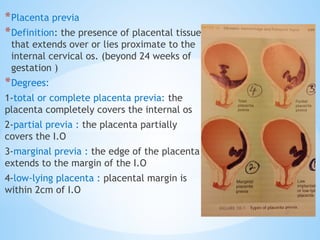 Lecture 4 - Placental abruption& previa.pptx