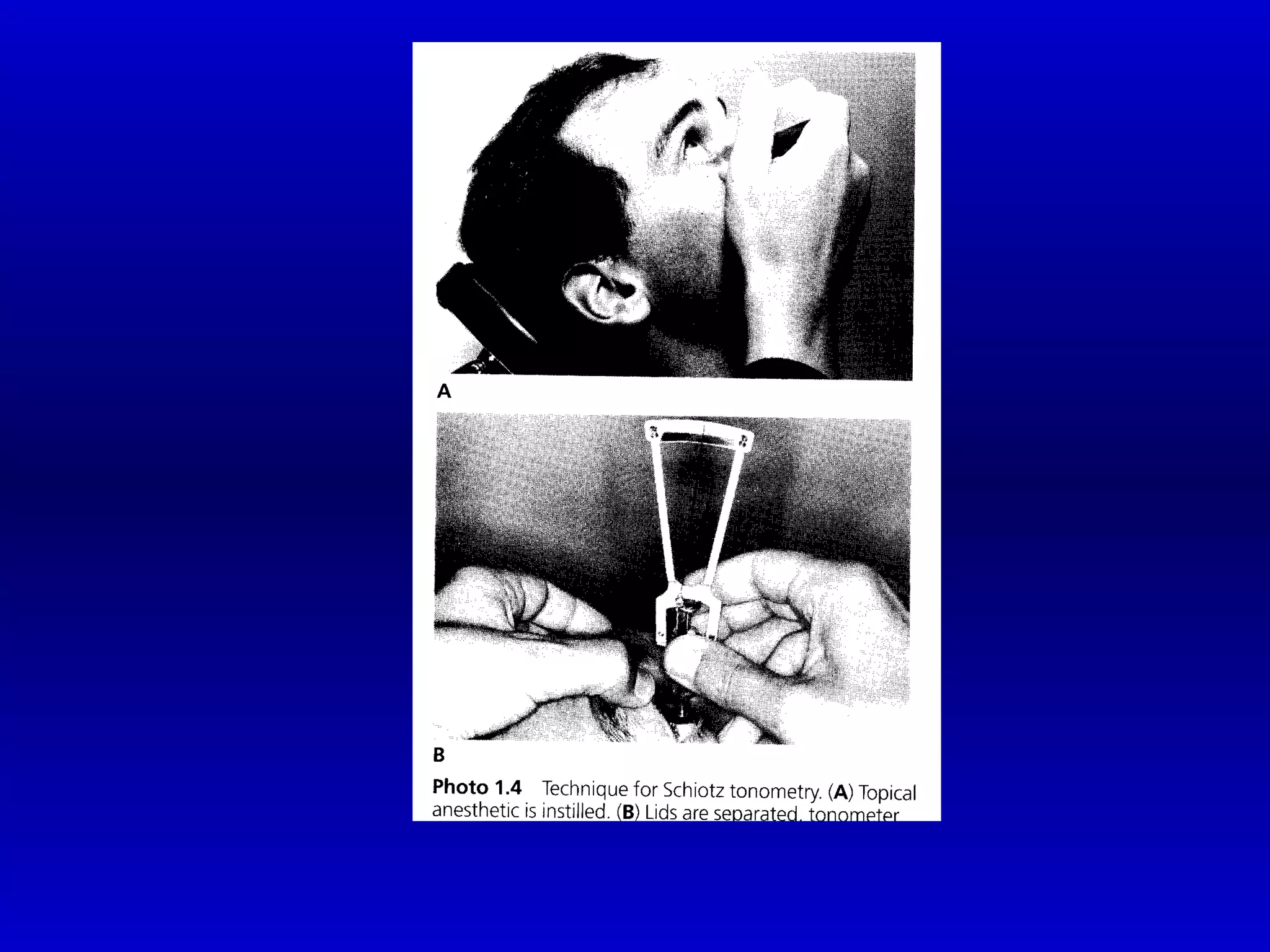 Lecture4 subjective and objective eye exam | PPT