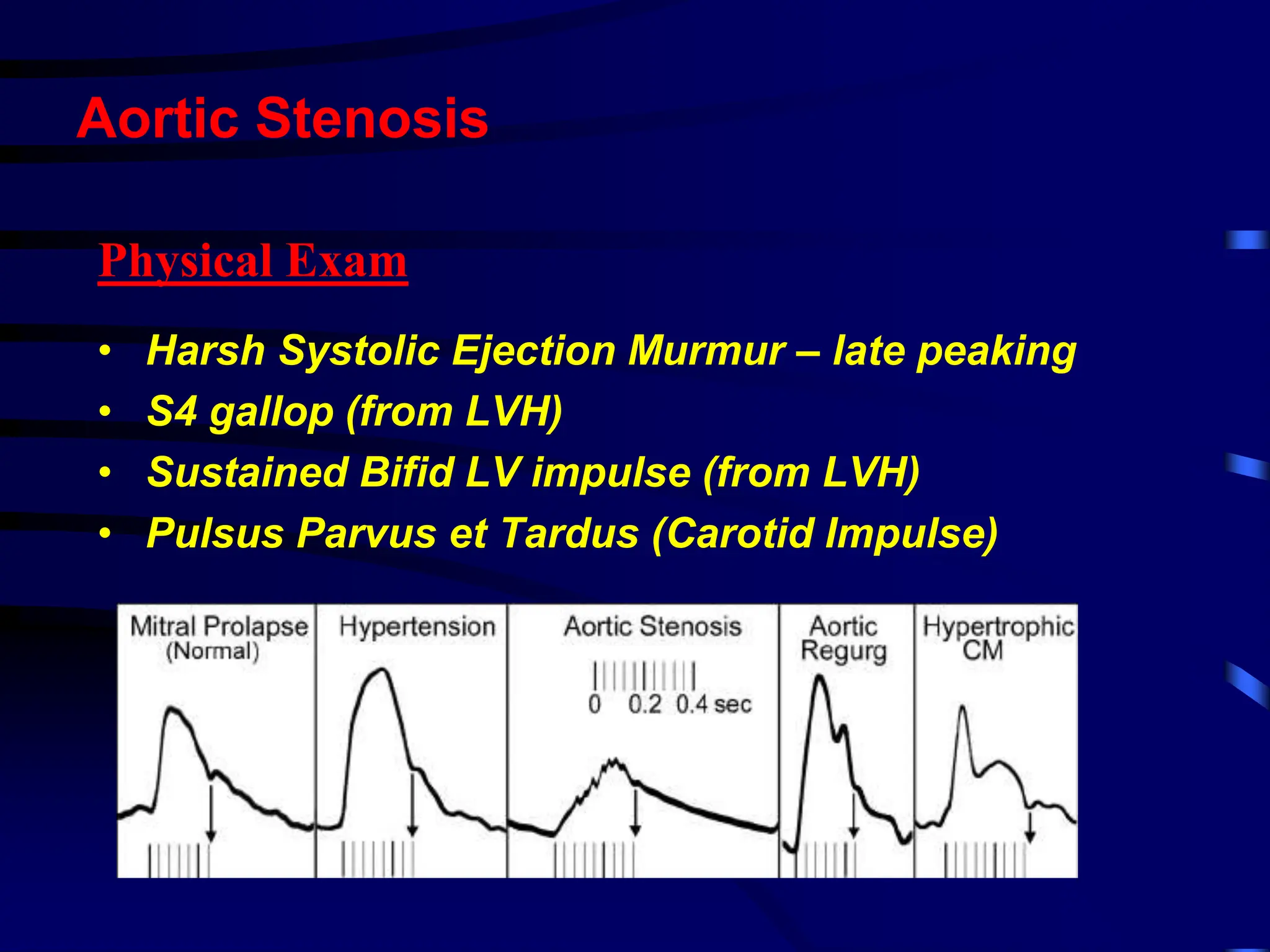 Lecture 4-Valvuddddlar Heart Diseases.ppt