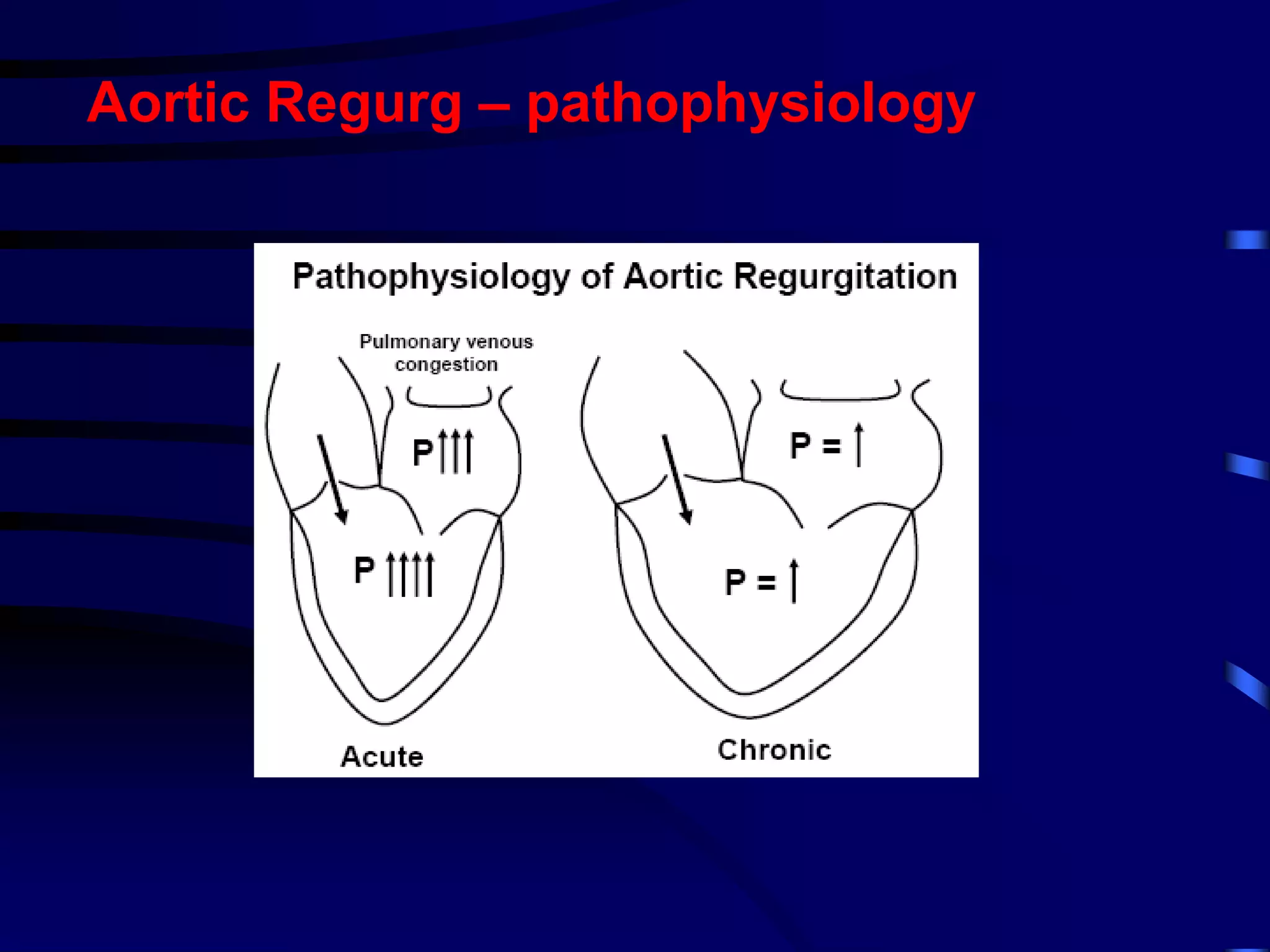 Lecture 4-Valvular Heart Diseases (1).ppt