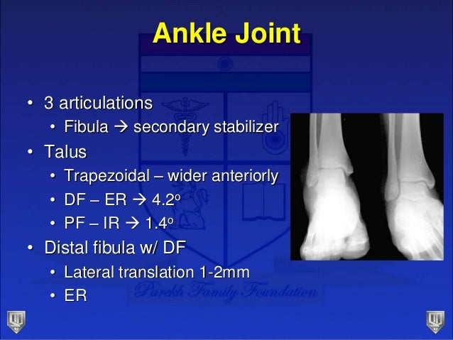 Lecture 40 Parekh Malunited Ankle Fracture