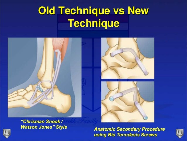 Lecture 41 parekh er f&a
