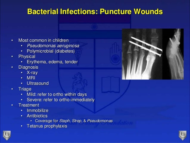Lecture 41 parekh er f&a