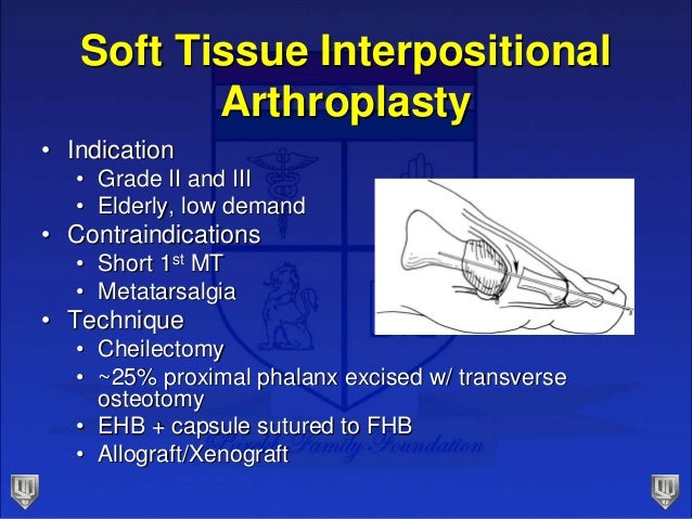 Lecture 46 parekh hr