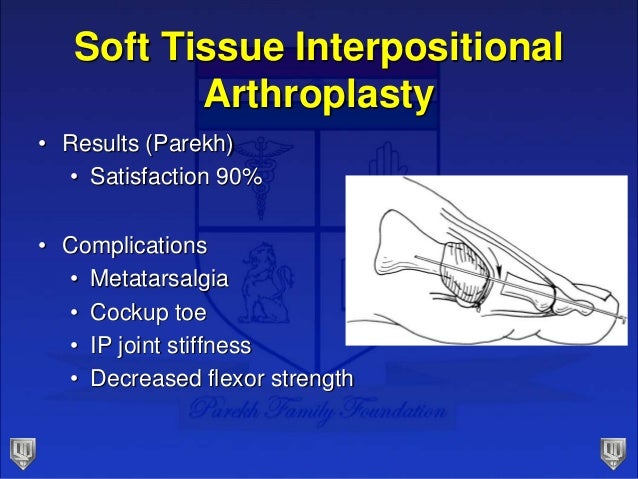 Lecture 46 parekh hr