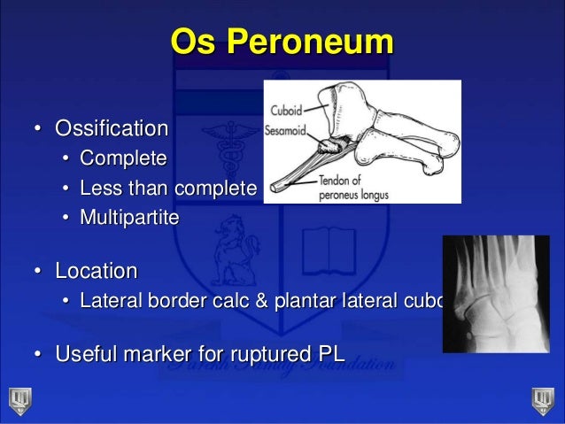 Lecture 47 parekh sports f&a