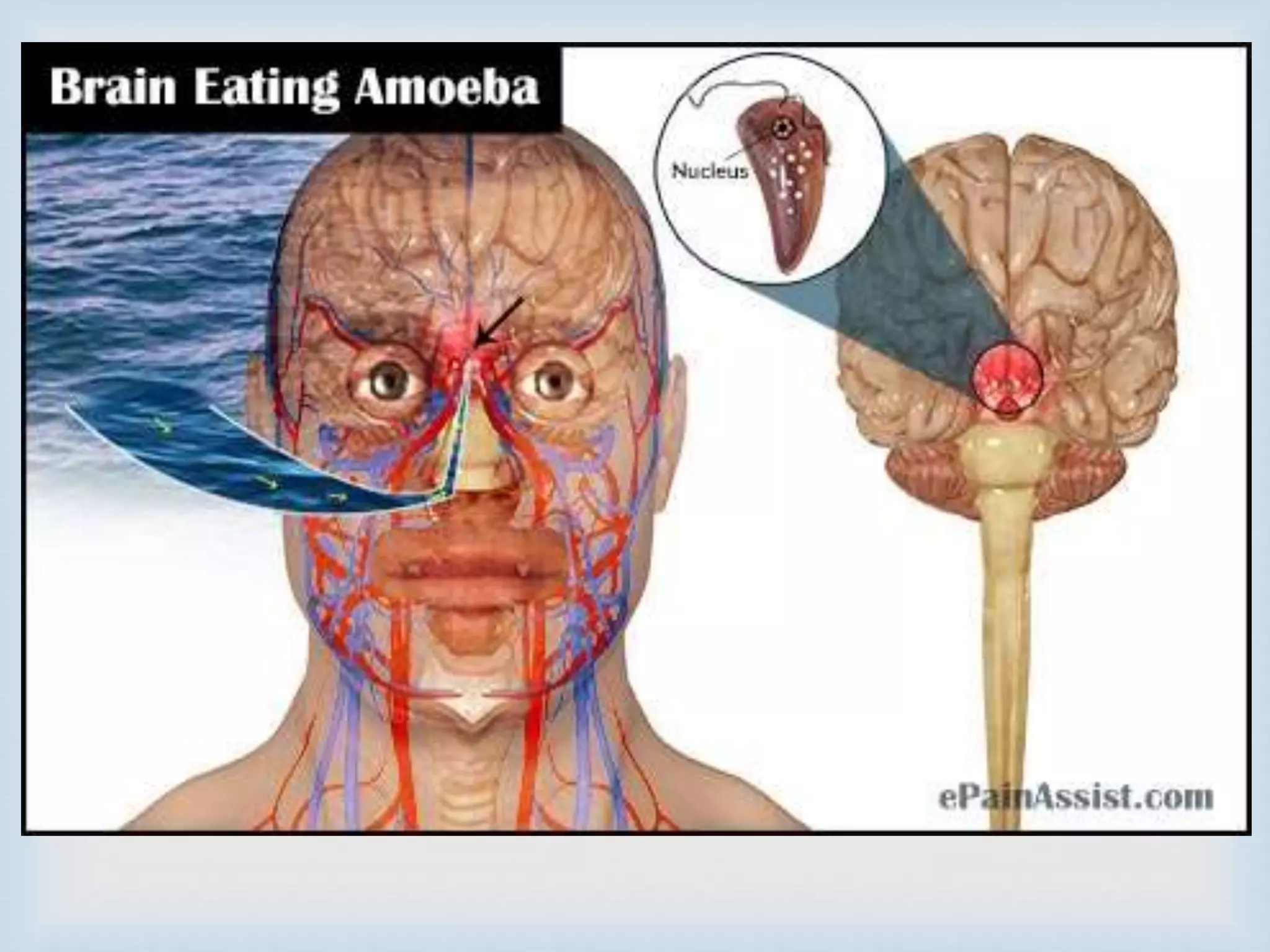 amoeba infecting brain and eyes | PPTX