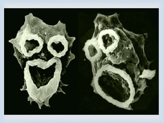 amoeba infecting brain and eyes | PPTX