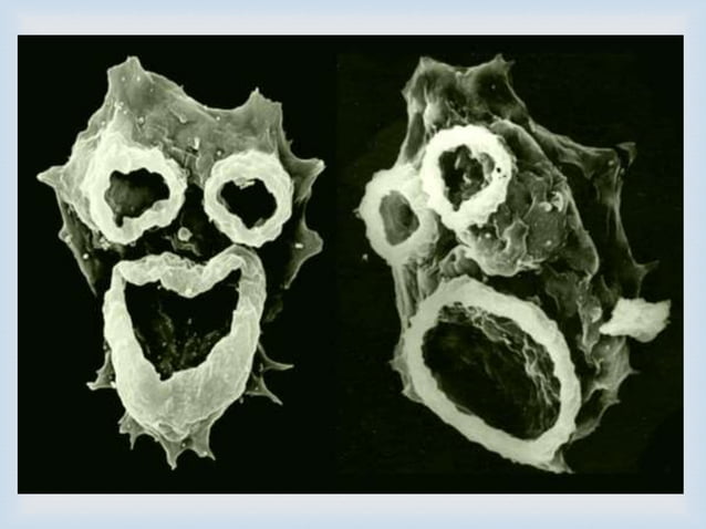 amoeba infecting brain and eyes | PPT