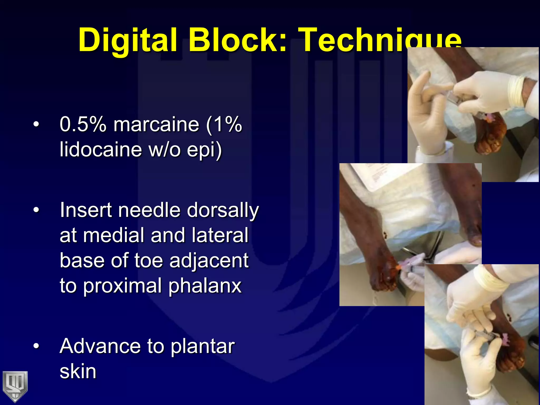 Lecture 4 and 5 parekh regional anesthesia | PPTX