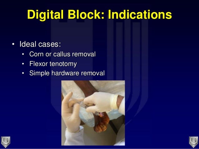 Lecture 4 and 5 parekh regional anesthesia
