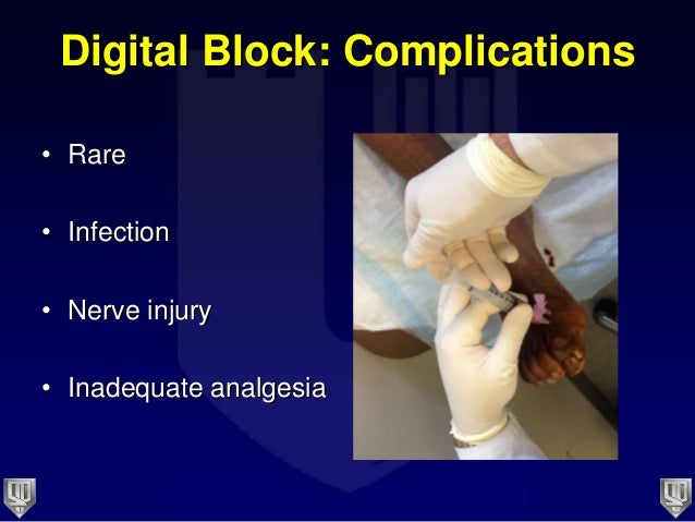 Lecture 4 and 5 parekh regional anesthesia