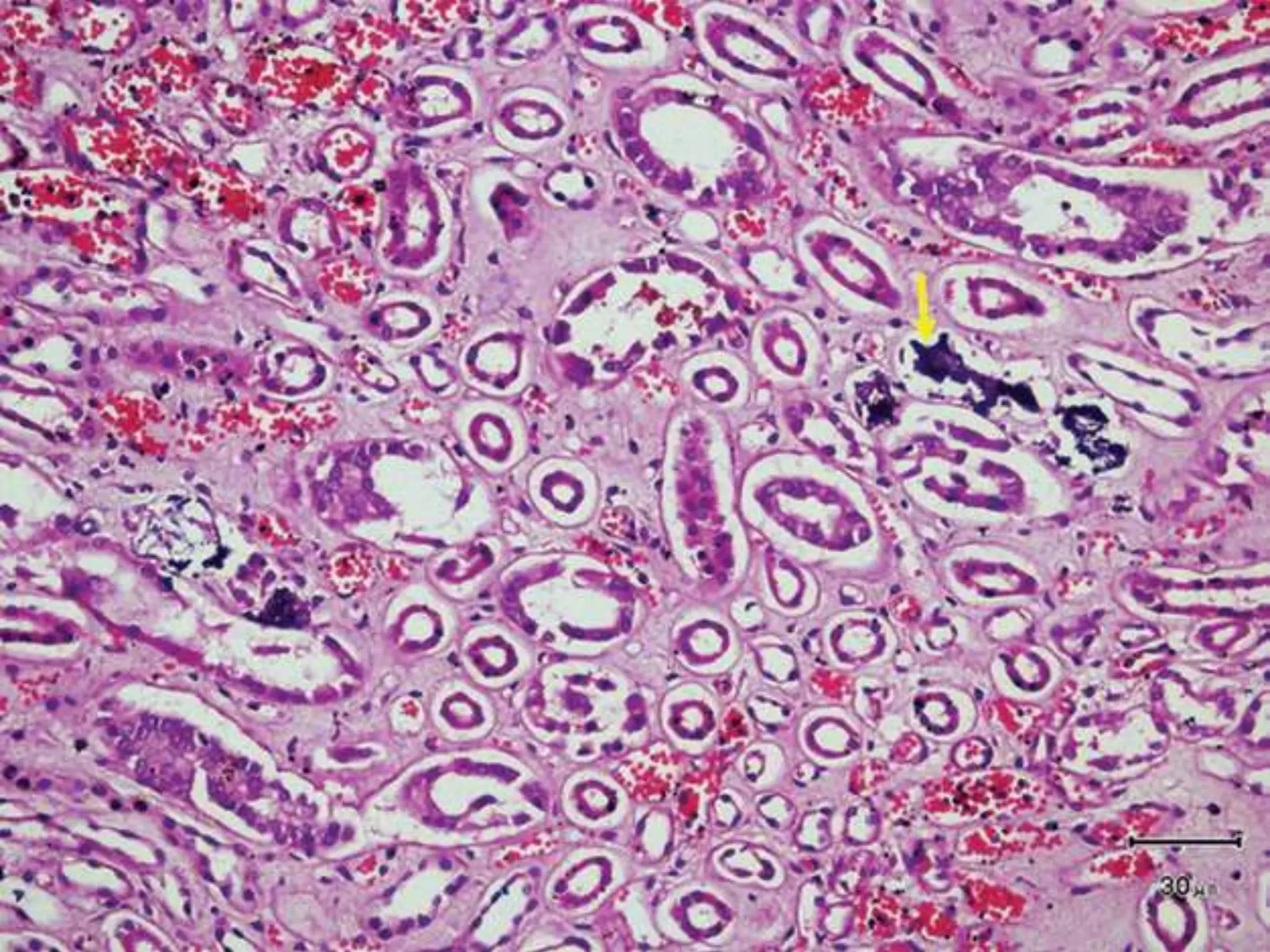 Lecture (4) commonly used fixatives in the laboratory | PPTX
