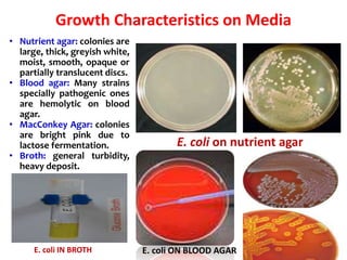 E Coli Plate Morphology