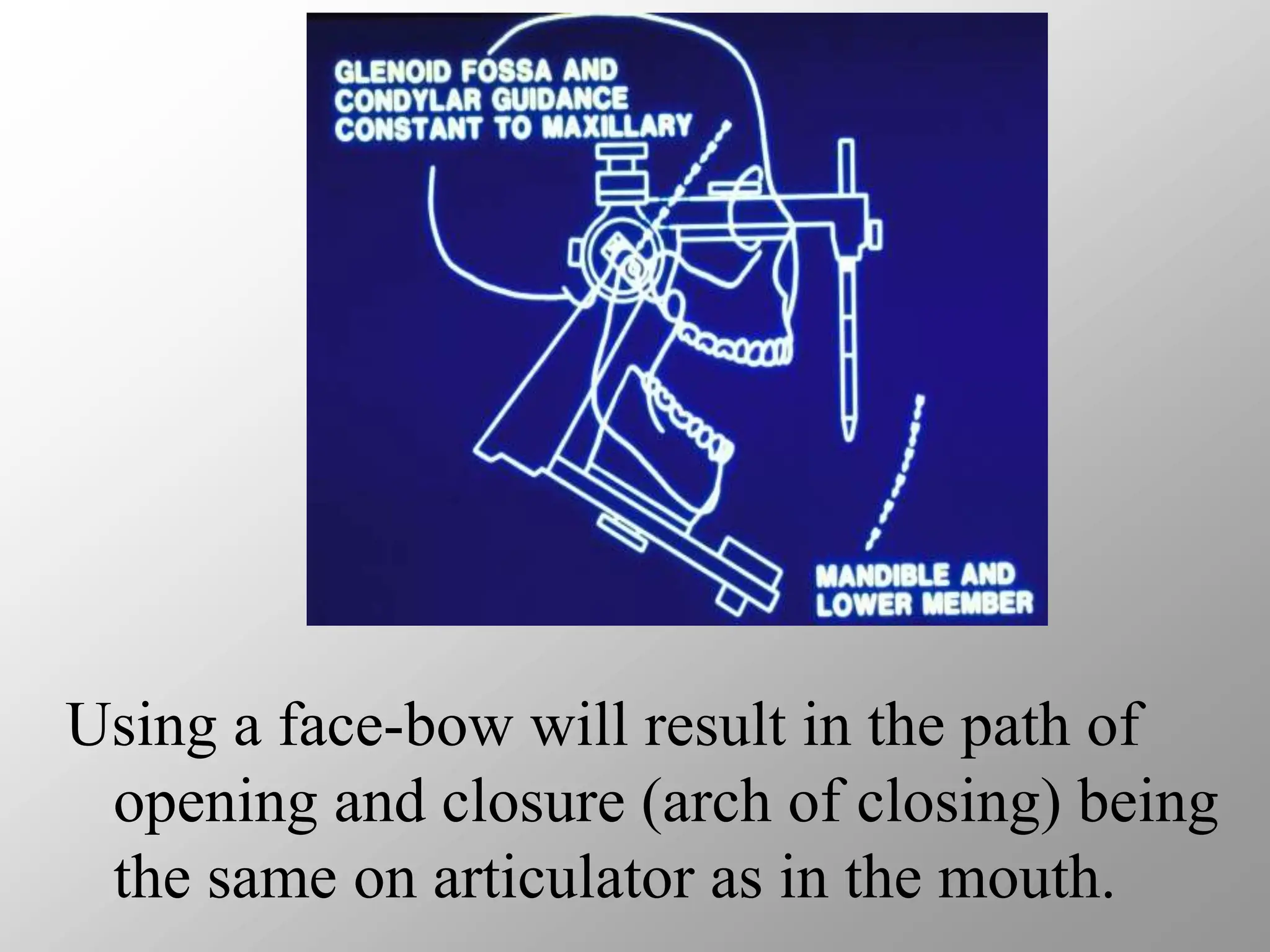 Lecture 4 Face-bow and m Articulators pdf | PDF