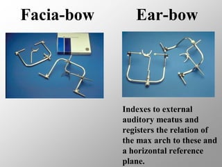 Lecture 4 Face-bow and m Articulators pdf | PDF