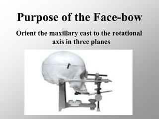 Lecture 4 Face-bow and m Articulators pdf | PDF