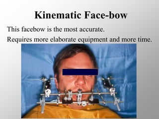Lecture 4 Face-bow and m Articulators pdf | PDF