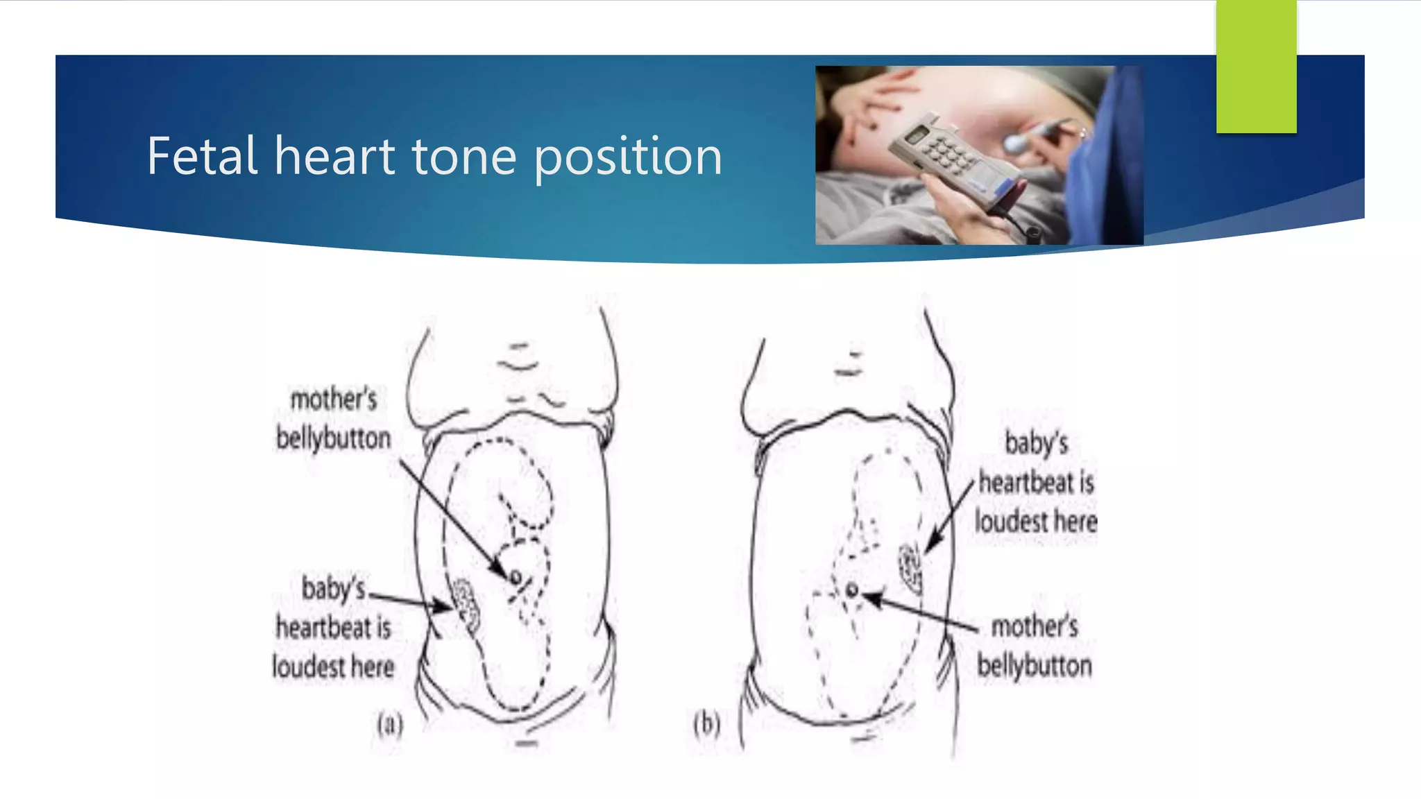 Lecture 4 Role of ultrasound in obstetrics | PPT