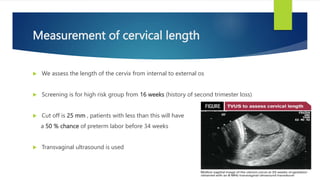 Lecture 4 Role of ultrasound in obstetrics | PPT