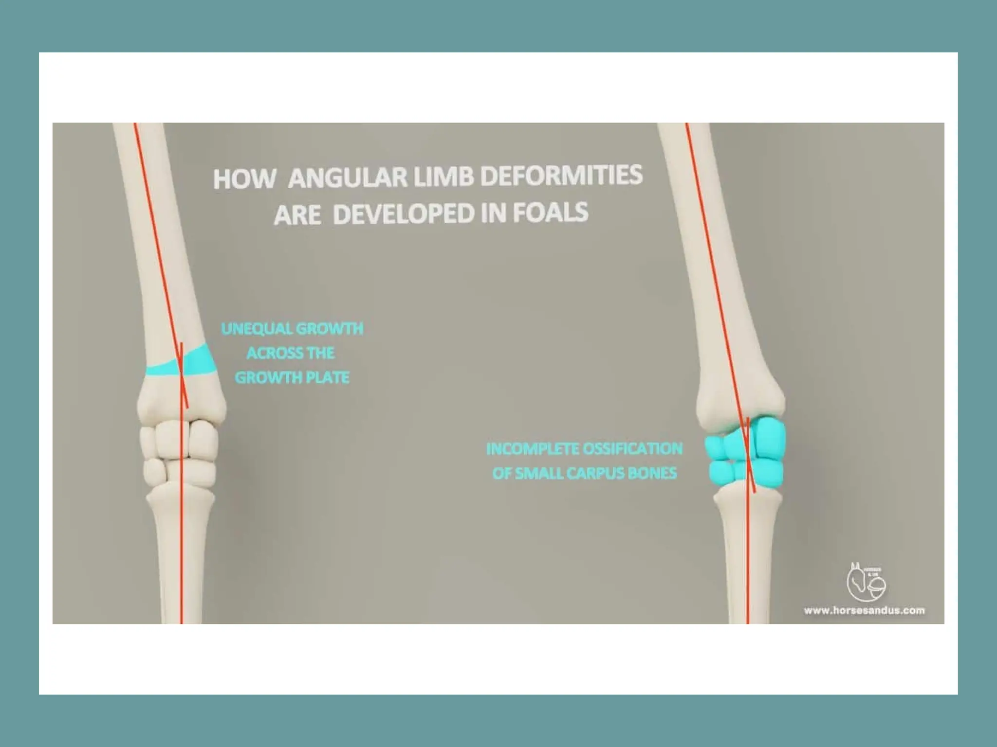 Lecture 4 Shoulder slip (sweeny)^J bicipital bursitis^J omarthritis^J ...