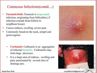 Staphylococcus | PPTX