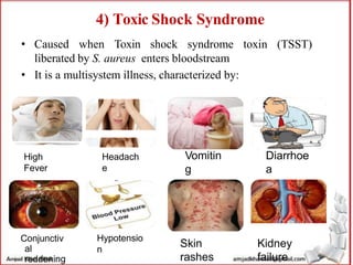 Staphylococcus | PPTX