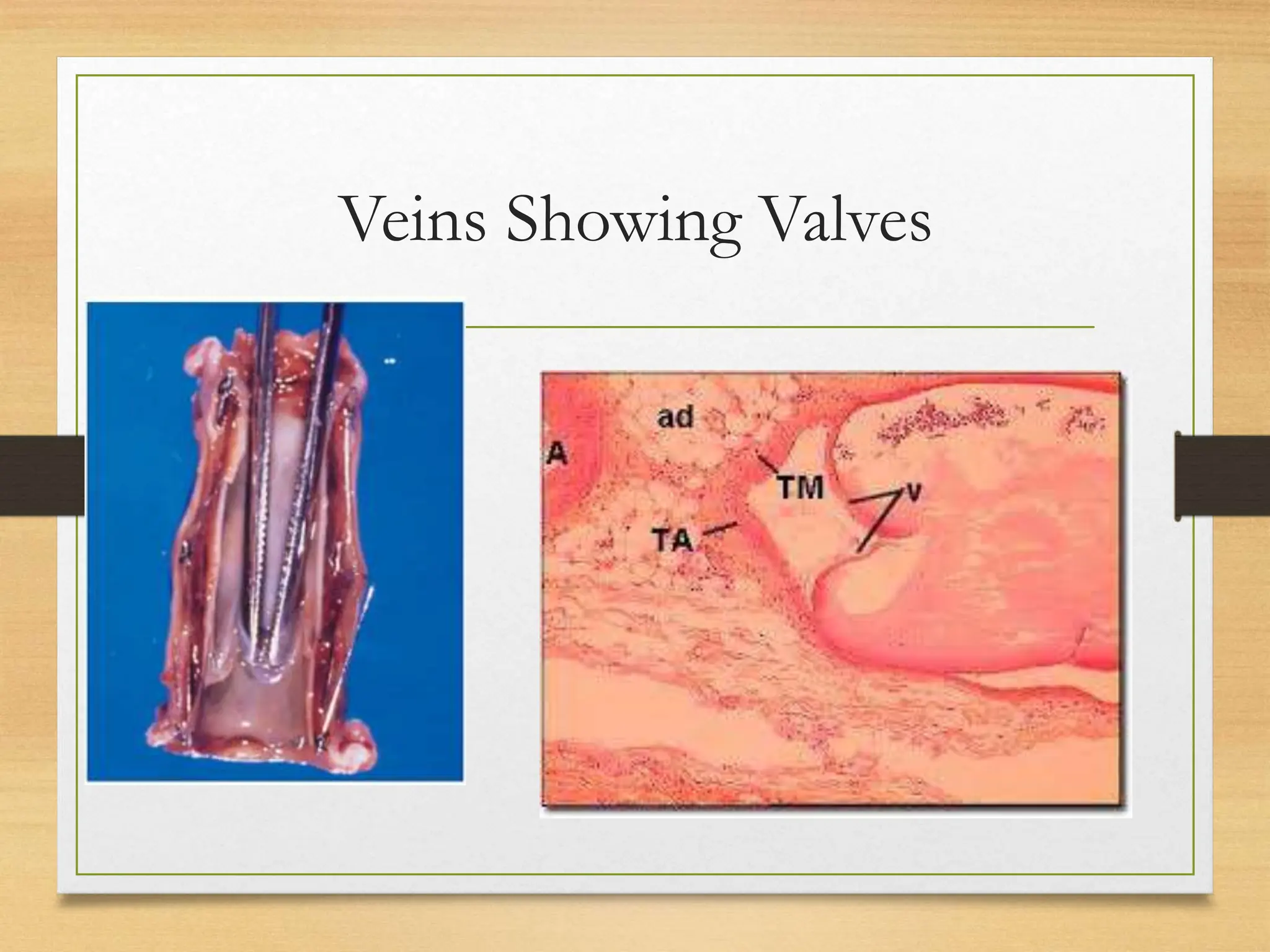 LECTURE 4_ The Conducting System of the Heart _ Blood Vessels.ppt