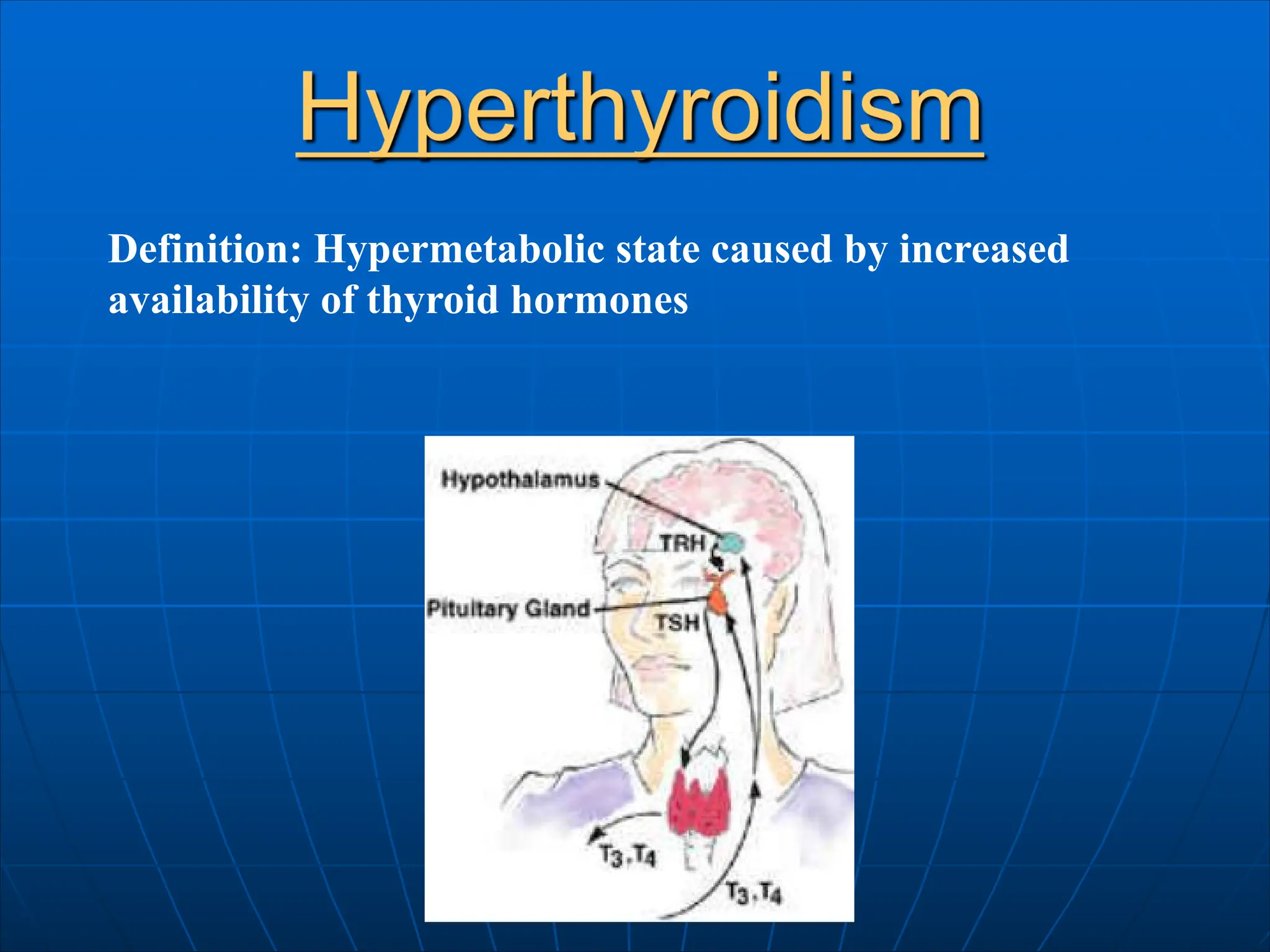 Lecture 4 of Thyroid gland classification, Hypo and hyper peculiarities ...