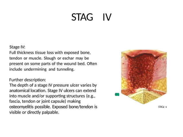 Types, Etiology, and Management of Wound | PPT