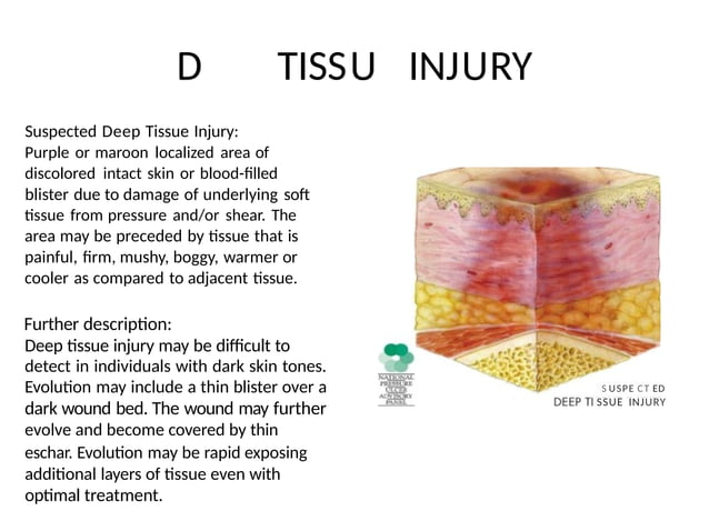 Types, Etiology, and Management of Wound | PPT