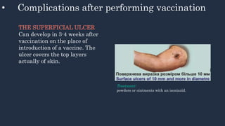 Prophylaxis of tuberculosis | PPTX