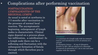 Prophylaxis of tuberculosis | PPTX